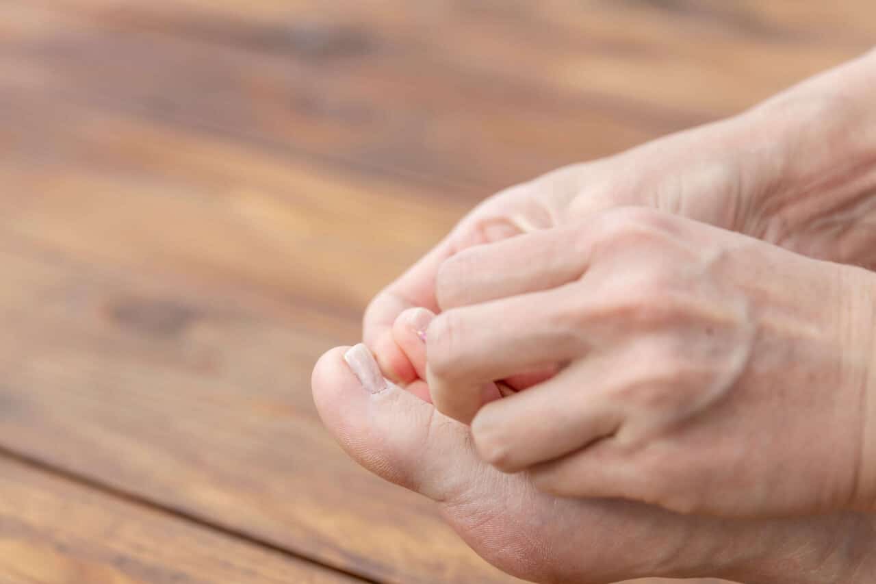 How to Cut Toenails to Prevent Ingrown Toenails: A Step-by-Step Guide ...